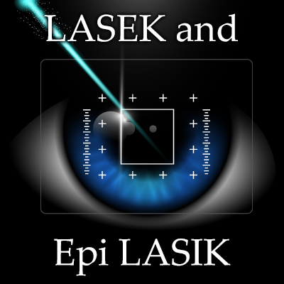 Epi Lasik Epi LASIK And LASEK Surgery: A Gentle Approach To Vision ...