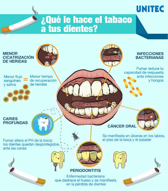 El Tabaco Y Tus Dientes 5 Efectos De Fumar Que Desconocías