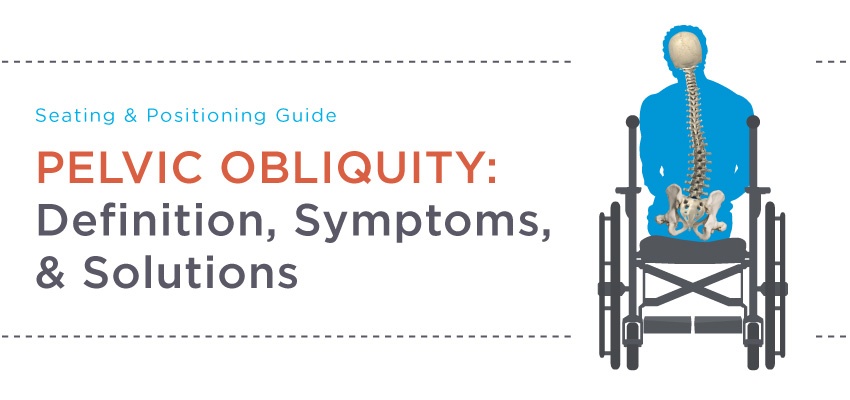 Pelvic Obliquity: Definition, Symptoms and Solutions