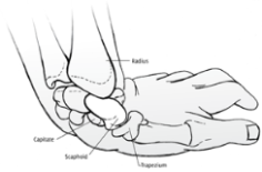 Wrist Pain after a Fall on an Outstretched Hand (FOOSH)