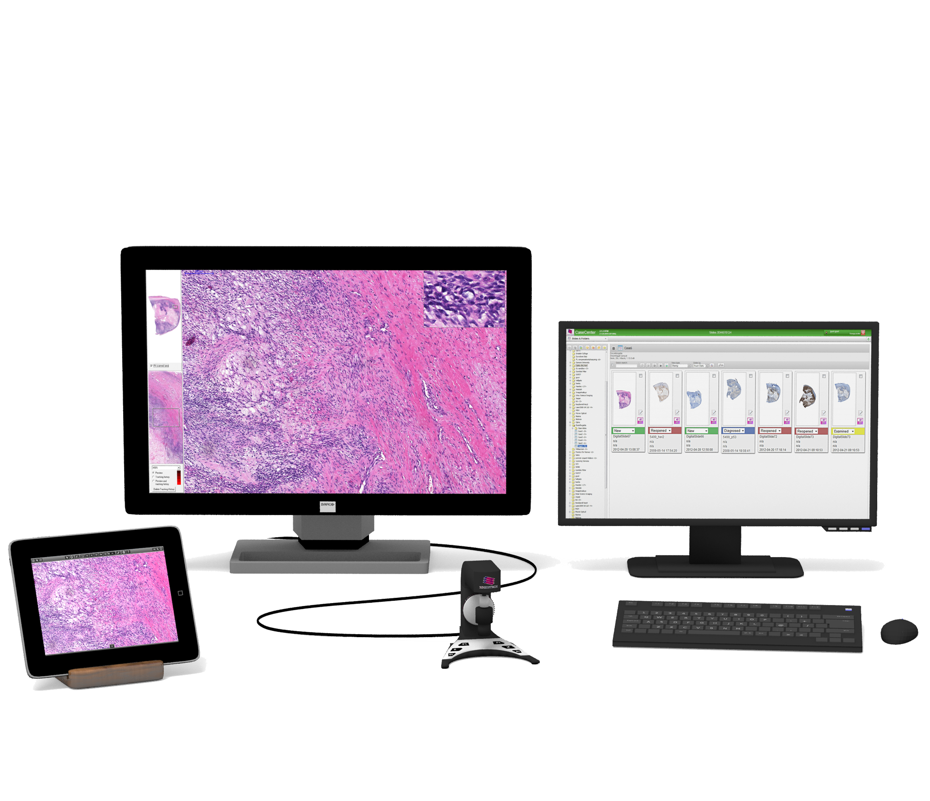 Digital Pathology Getting Closer to the Clinic in the US