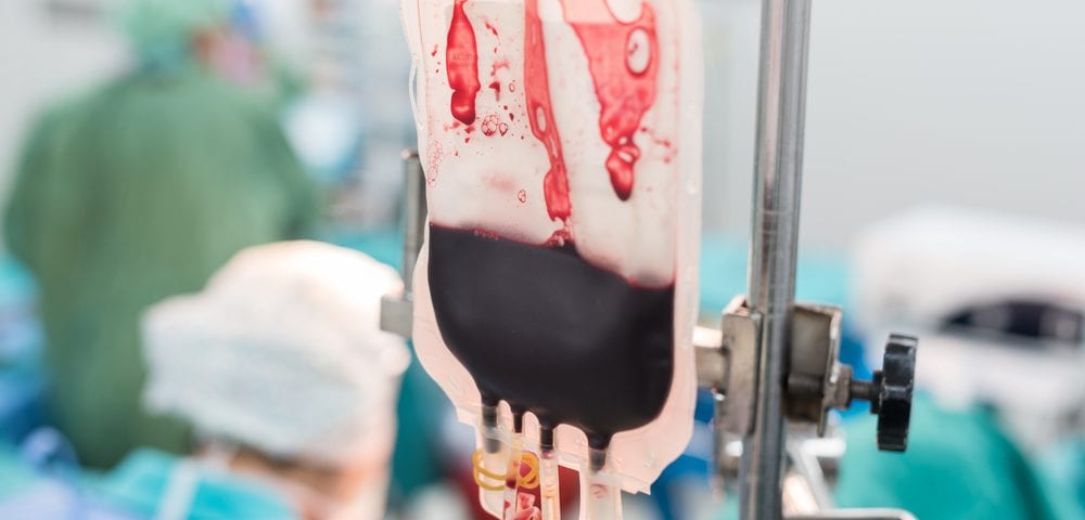 5 Things You Should Know About Bone Marrow Transplant